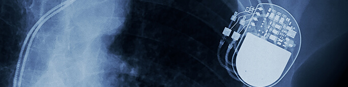 Parylene Coating Properties - Tables of Values, Types & Data Sheets